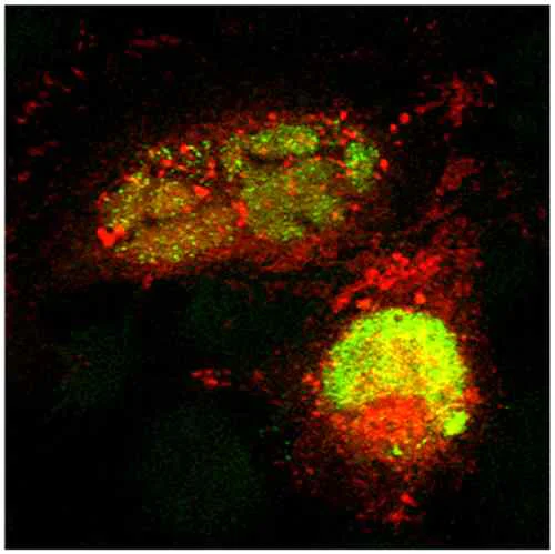 HSV1 + HSV2 VP16抗体[LP1] (ab110226)| Abcam中文官网