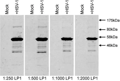 HSV1 + HSV2 VP16抗体[LP1] (ab110226)| Abcam中文官网