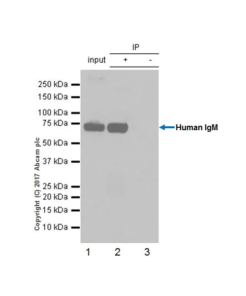 Anti-Human IgM antibody [EPR20731] (ab212201) | Abcam