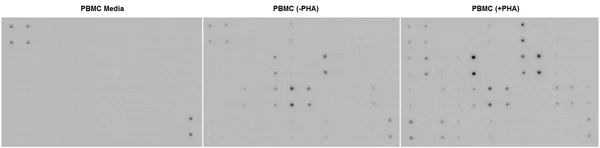 Human Inflammation Antibody Array - Membrane (40 Targets) (ab134003 ...