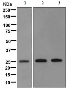 Anti-Human Kappa Chain antibody [EPR11633] - BSA and Azide free ...