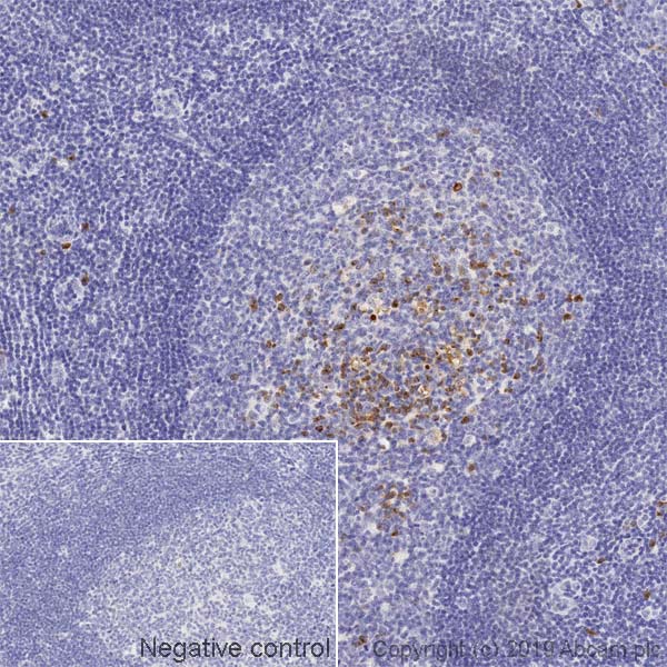 Anti-Human Kappa Chain antibody [TB-28] - BSA and Azide free (ab235128 ...