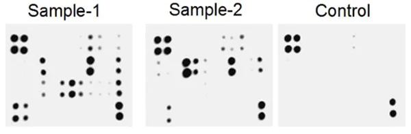 Human Neuro Antibody Array I (Membrane, 20 Targets) (ab211062) | Abcam