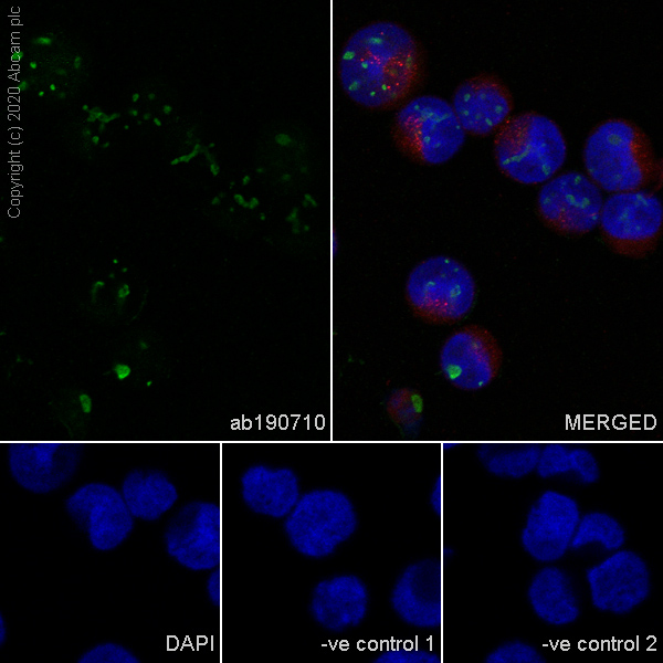 Anti-Human Nucleoli antibody [NM95] - Nucleolar Marker (ab190710) | Abcam