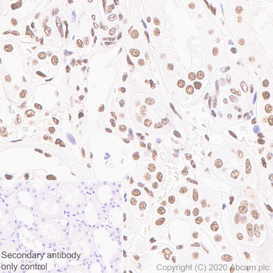 Anti-Human Nucleoli antibody [NM95] - Nucleolar Marker (ab190710) | Abcam