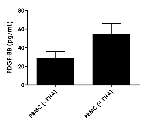 Human PDGF BB ELISA Kit (ab184860) | Abcam