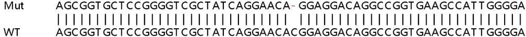 Human SLC22A5 (Solute carrier family 22 member 5) knockout HeLa cell ...
