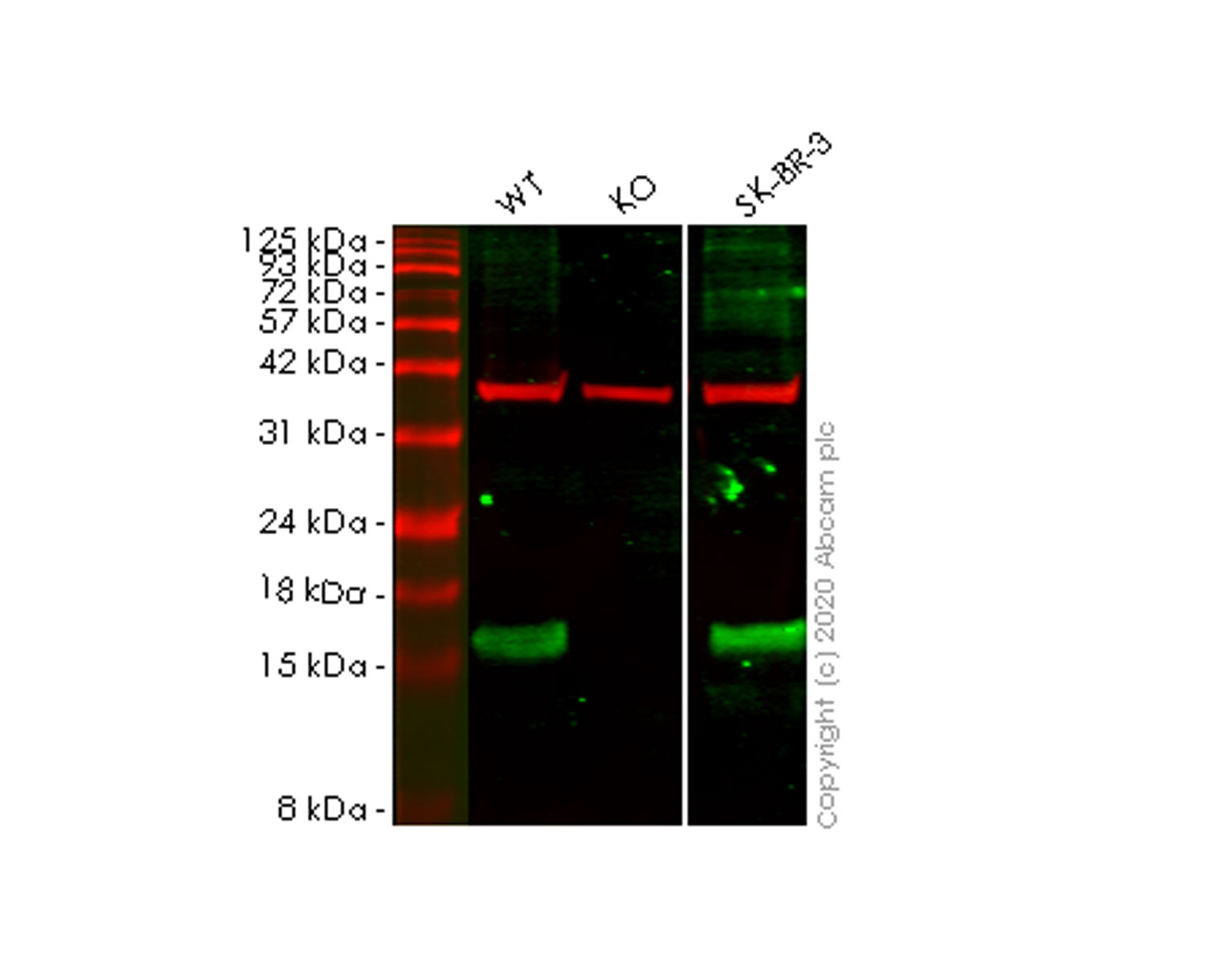 Human SNCG (gamma Synuclein) knockout HeLa cell line (ab265623) | Abcam