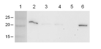 Human SOD2 ELISA Kit, colorimetric, 90-min ELISA (ab178012) | Abcam