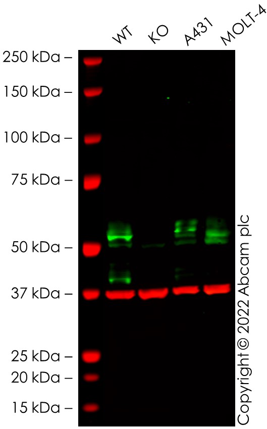 Human TGFBR1 knockout A549 cell line (ab277894) | Abcam