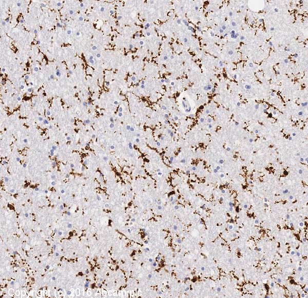 Iba1抗体- Microglia marker (ab5076)| Abcam中文官网