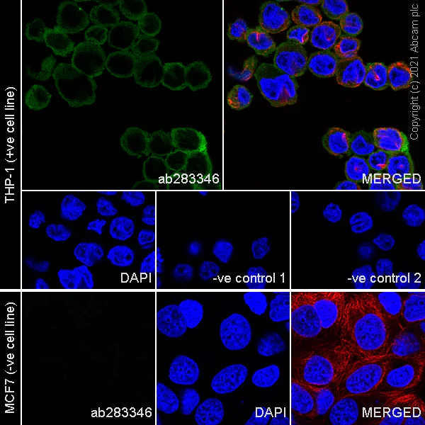 Iba1抗体[EPR16589] - Microglia marker - Rat IgG2a (Chimeric) (ab283346 ...