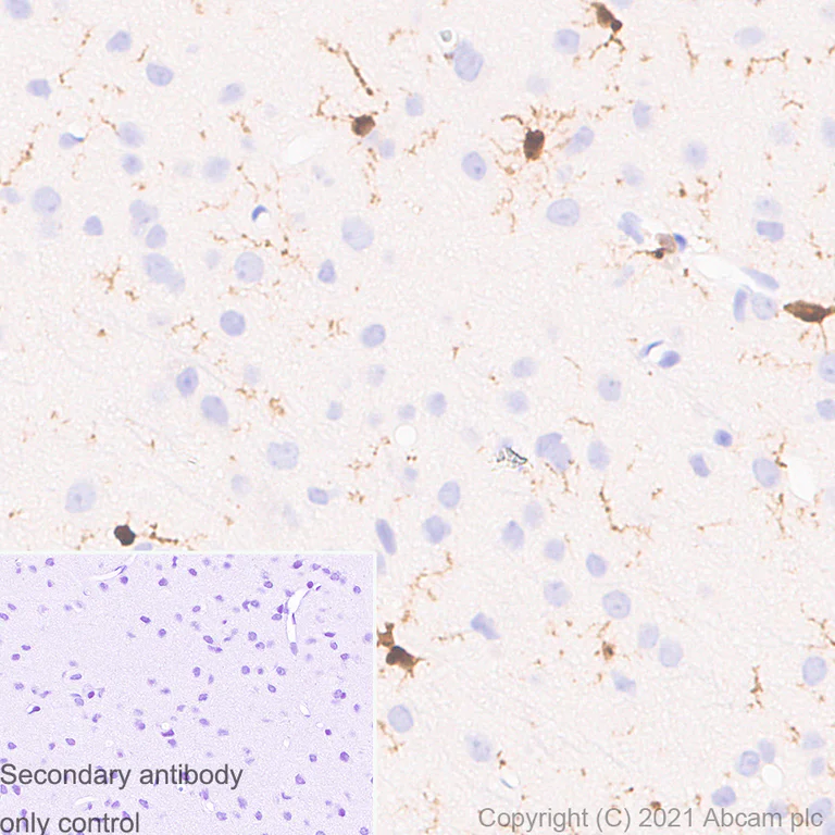 Anti-Iba1 antibody [EPR16589]. Rat Monoclonal (ab283346) | Abcam
