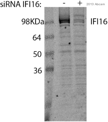 Anti-IFI16 antibody [2E3] (ab55328) | Abcam