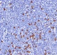 Anti-Ig kappa chain V-ID region 16 antibody [L1C1] (ab208164) | Abcam
