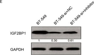Anti-IGF2BP1/IMP1 antibody [EPR18791] (ab184305) | Abcam