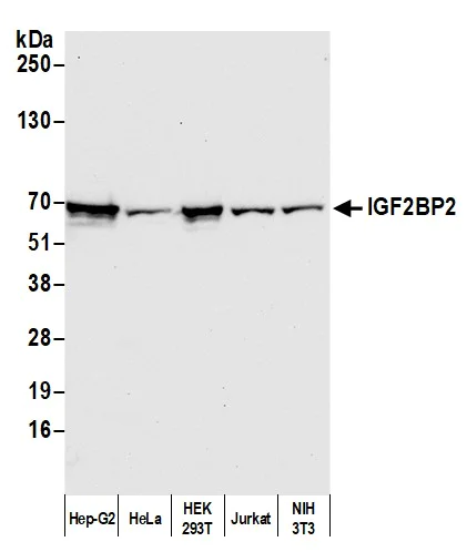 Anti-IGF2BP2/IMP-2 antibody [1E3.01E5] (ab128175) | Abcam