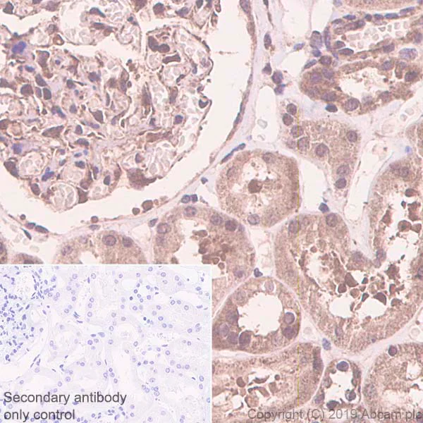 Anti-IKB beta antibody [EPR5037] (ab109509) | Abcam