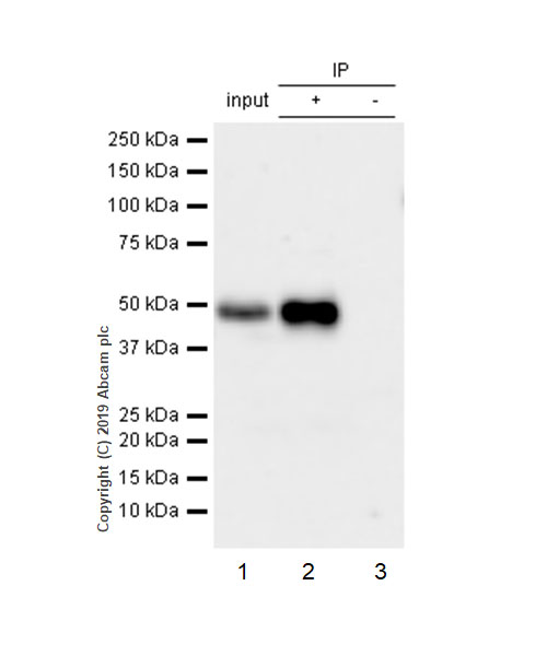 Anti-IKB beta antibody [EPR5037] (ab109509) | Abcam
