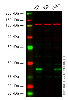 Anti-IKB beta antibody [EPR5037] (ab109509) | Abcam