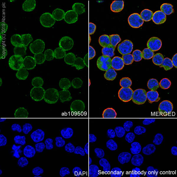 Anti-IKB beta antibody [EPR5037] - BSA and Azide free (ab247886) | Abcam
