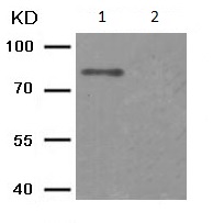 Anti-IKK alpha + IKK beta (phospho S176 + S177) antibody (ab194528) | Abcam