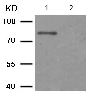 Anti-IKK alpha + IKK beta (phospho S176 + S177) antibody (ab194528) | Abcam