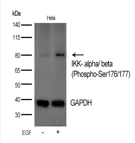 Anti-IKK alpha + IKK beta (phospho S176 + S177) antibody (ab194528) | Abcam