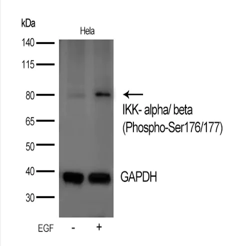 Anti-IKK alpha + IKK beta (phospho S176 + S177) antibody (ab194528) | Abcam