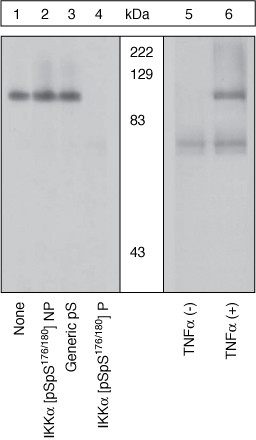 Anti-IKK alpha (phospho S176 + S180) antibody (ab17943) | Abcam
