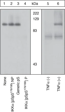 Anti-IKK alpha (phospho S176 + S180) antibody (ab17943) | Abcam