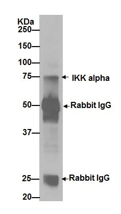 Anti- IKK beta antibody [EPR16628] (ab178870) | Abcam
