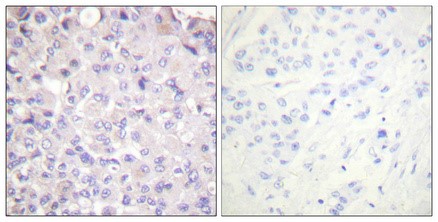 Anti-IKK beta (phospho Y188) antibody (ab194519) | Abcam