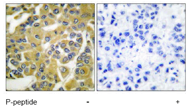 Anti-IKK beta (phospho Y188) antibody (ab53694) | Abcam