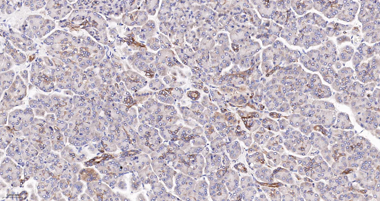 Anti-IKK epsilon antibody [5D10] (ab326713) | Abcam中文官网