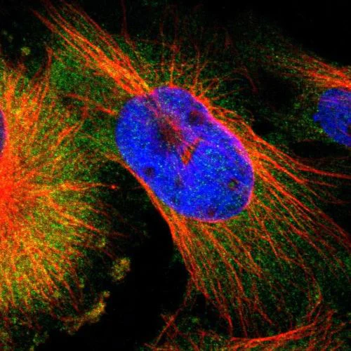 Anti-IKK gamma/NEMO antibody (ab244244) | Abcam