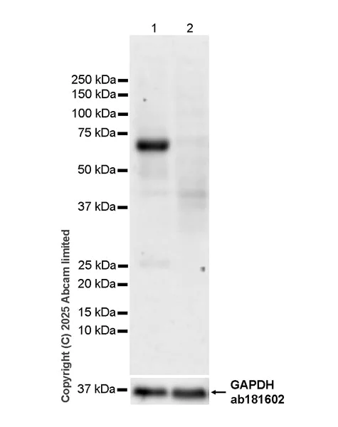 Anti-IL-10RB/IL-10R2 antibody [EPR28963-63] (ab325237) | Abcam中文官网