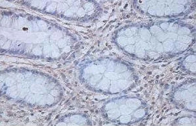 IL-12 p40抗体 (ab106270)| Abcam中文官网