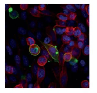 Anti-IL-13 receptor alpha 1 antibody [GM1E7] (ab39418) | Abcam