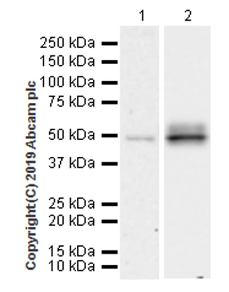 IL-2 Receptor alpha抗体[SP176] (ab231441)| Abcam中文官网