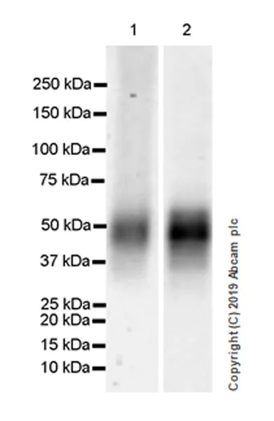 IL-2 Receptor alpha抗体[EPR22816-65] (ab264557)| Abcam中文官网