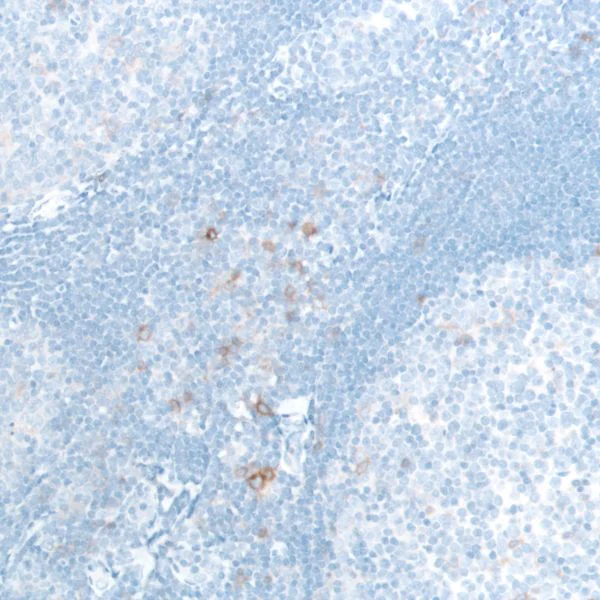 IL-2 Receptor alpha抗体[SP176] (ab231441)| Abcam中文官网