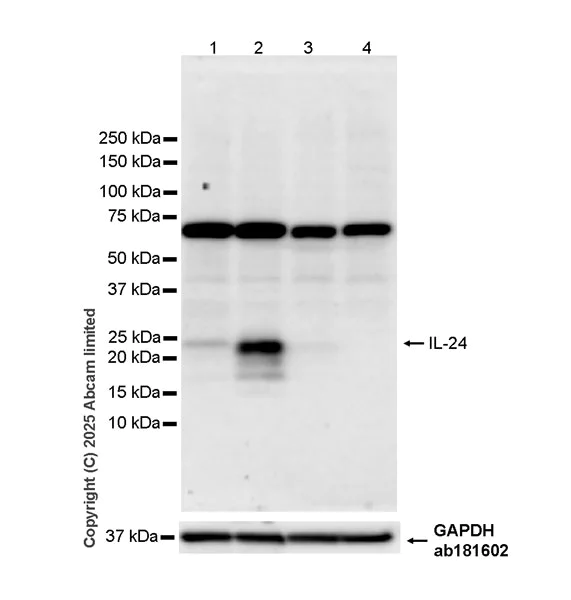 Anti-IL-24 antibody [EPR28683-20] (ab325236) | Abcam中文官网