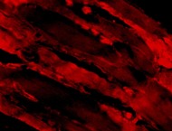 Anti-IL-31 antibody (ab62579) | Abcam