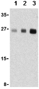 Anti-IL-31 antibody (ab62579) | Abcam