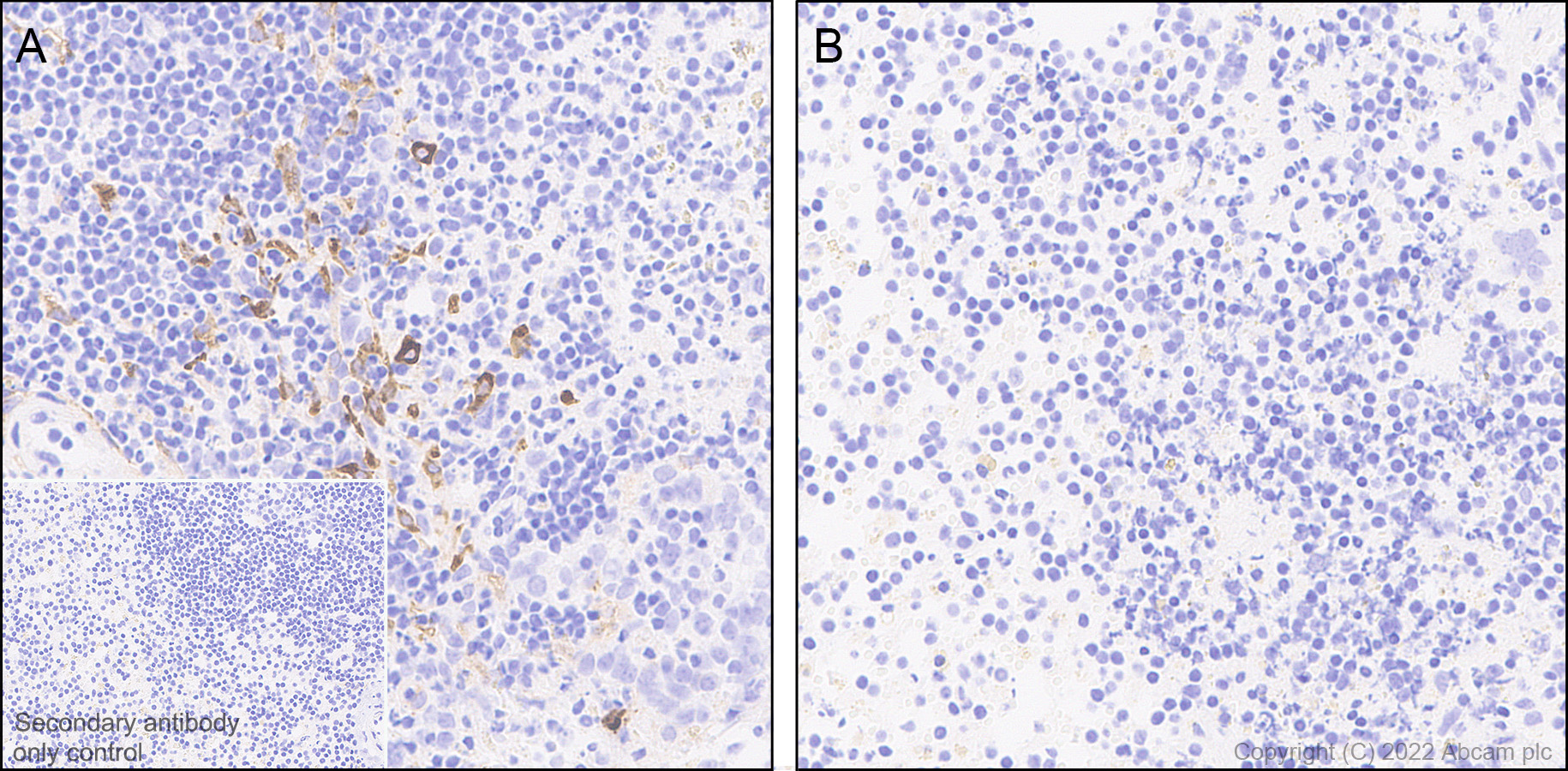 Anti-IL-6 antibody [EPR23819-103] (ab290735) | Abcam