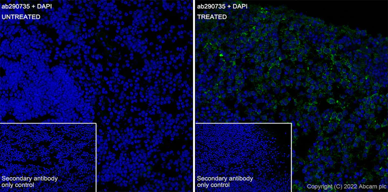 Anti-IL-6 antibody [EPR23819-103] (ab290735) | Abcam