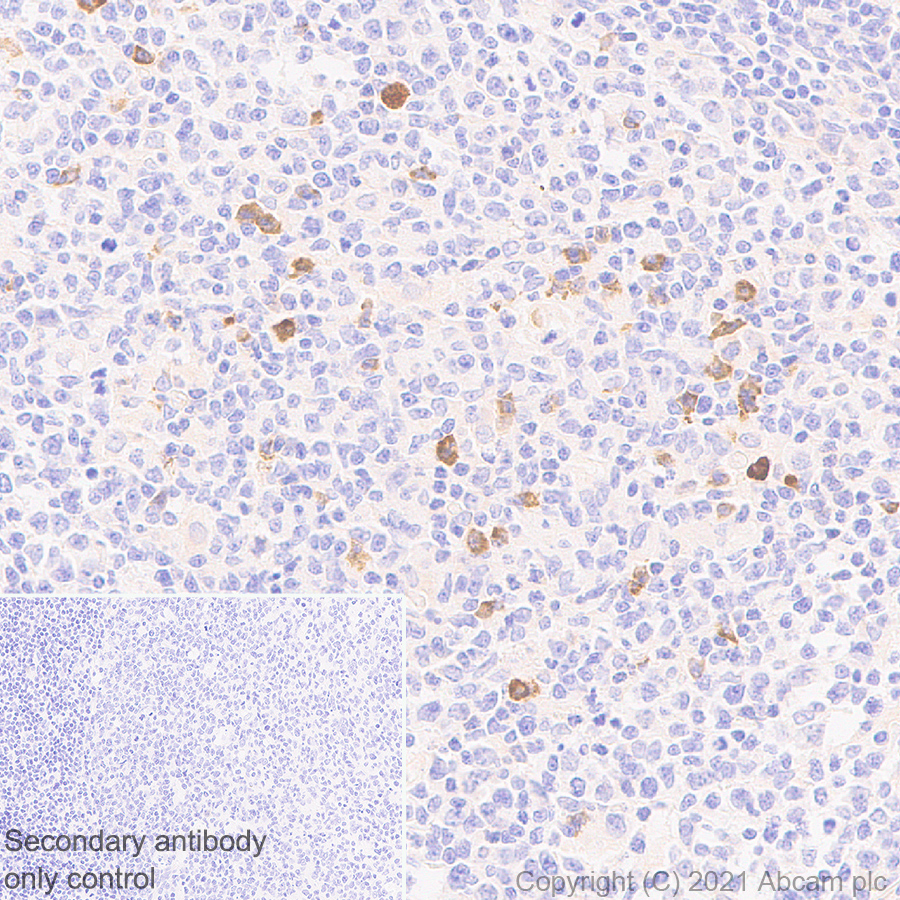 Anti-IL-6R antibody [EPR24322-143] 20 ul size (ab271042) | Abcam