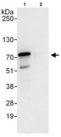 Anti-IMP3 antibody (ab225697) | Abcam