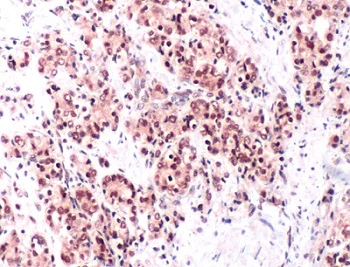 Anti-IMP3 antibody (ab231472) | Abcam